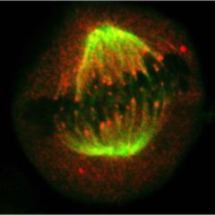 Kinetochor - DocCheck Flexikon
