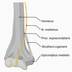 Struthers-Ligament - DocCheck Flexikon