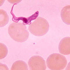 Josso-Loop - DocCheck Flexikon