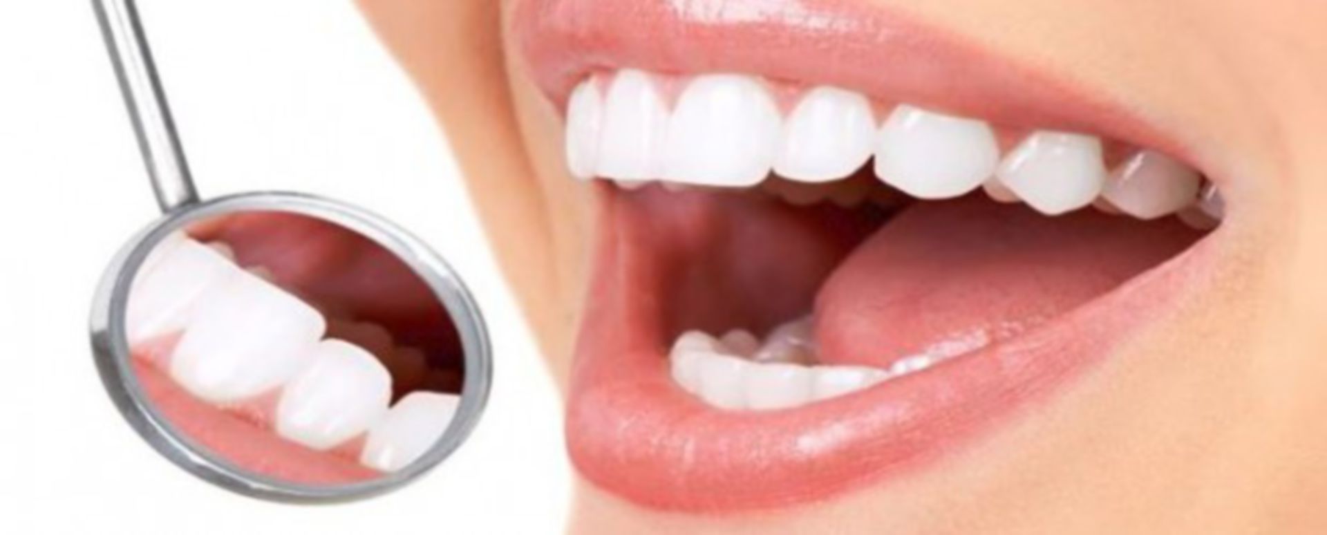 ¿Qué es la halitosis (mal aliento)? - DocCheck