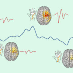 Reiz - DocCheck Flexikon