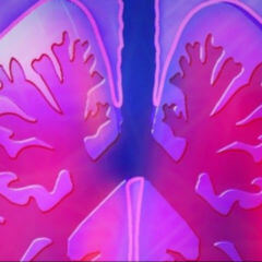 Bronchiektase - DocCheck Flexikon