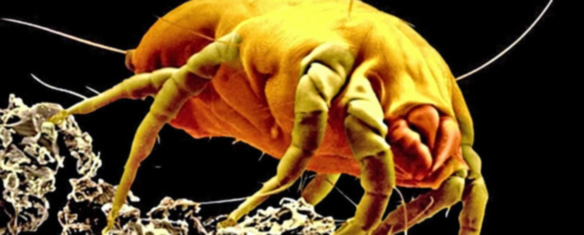 Von Hausstaubmilben und Allergie-Spätsündern - DocCheck