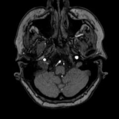 Intradural - DocCheck Flexikon