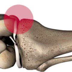 Payr-Zeichen - DocCheck Flexikon