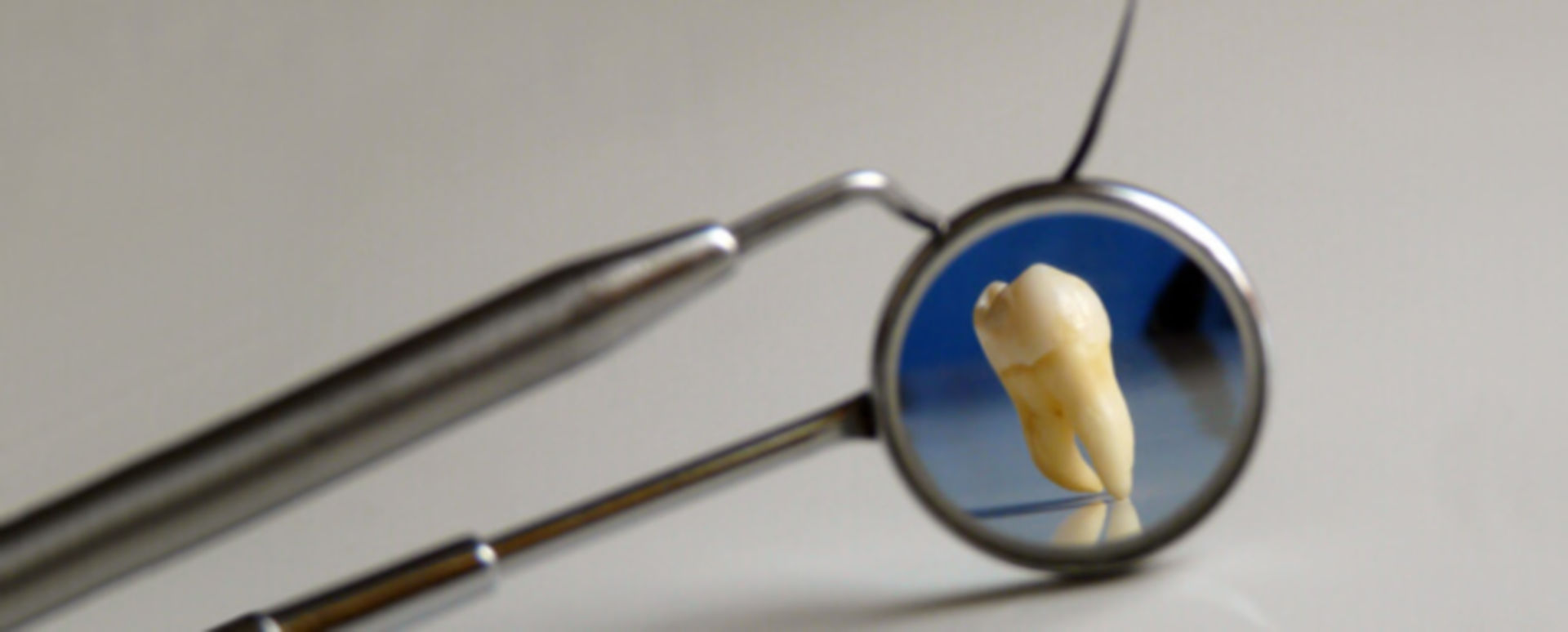 Parodontitis: Den Taschen auf den Zahn gefühlt - DocCheck