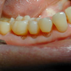 Zahnhals - DocCheck Flexikon