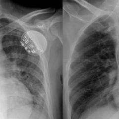 Trunci vagales - DocCheck Flexikon