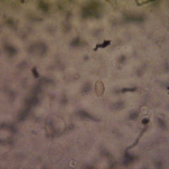 Helminthen - DocCheck Flexikon