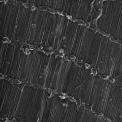 Myofibrille - DocCheck Flexikon