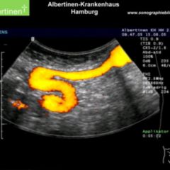 Leberpforte - DocCheck Flexikon