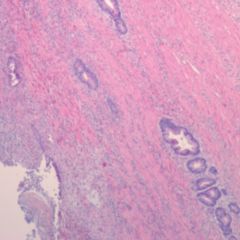 Fistel - DocCheck Flexikon