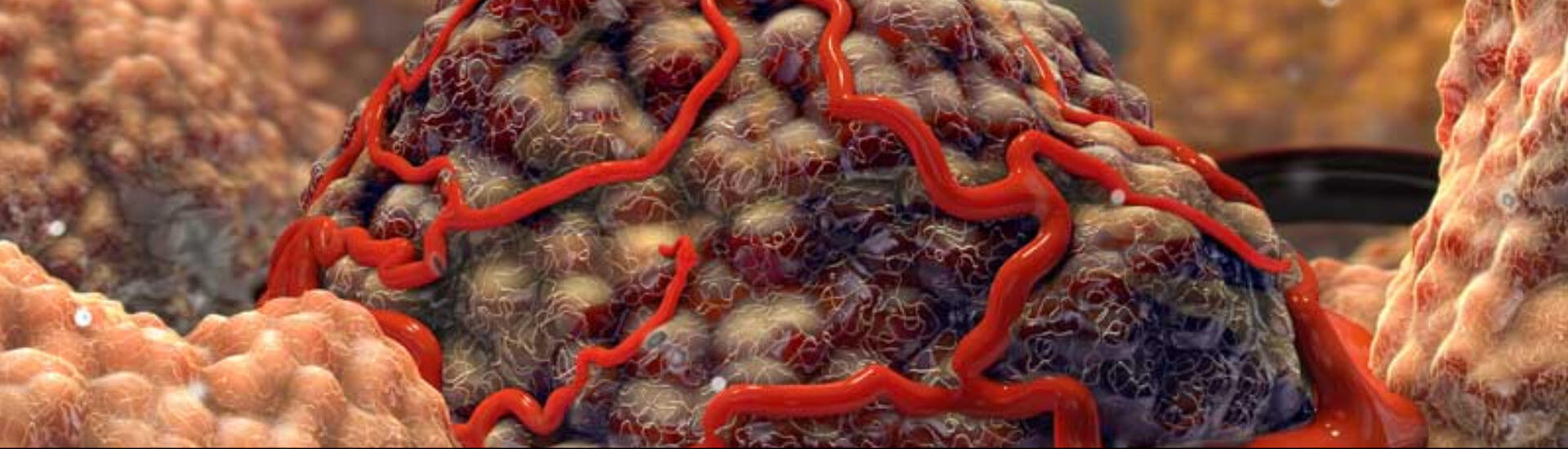 Neueinführung Retsevmo bei RET-Mutation - DocCheck