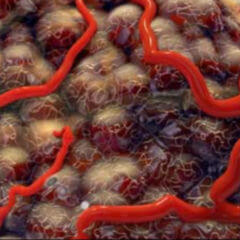 RET (Protoonkogen) - DocCheck Flexikon