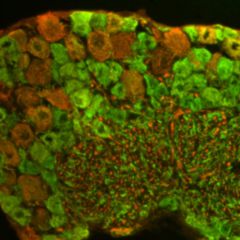 Neurofilament - DocCheck Flexikon