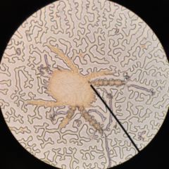 Neotrombicula autumnalis - DocCheck Flexikon