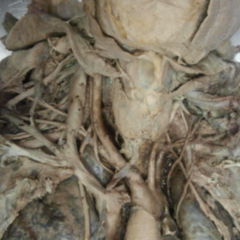 Truncus intestinalis - DocCheck Flexikon