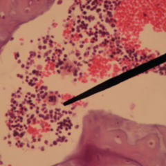 Bindegewebe - DocCheck Flexikon