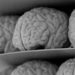 Prodrom - DocCheck Flexikon