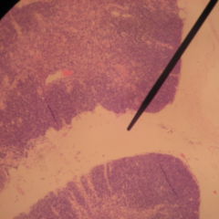 Trabekel - DocCheck Flexikon