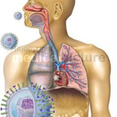 Infektionsweg - DocCheck Flexikon