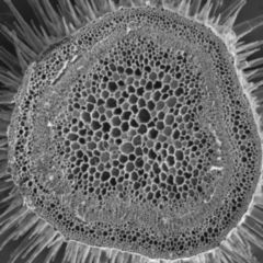 Scapula alata - DocCheck Flexikon