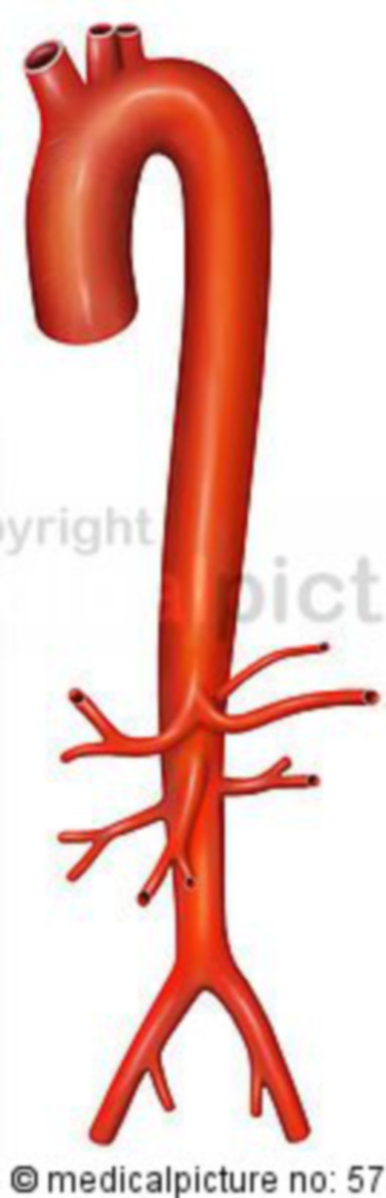 Anatomische Illustrationen - Aorta - DocCheck