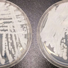 Hefen - DocCheck Flexikon