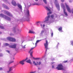 Urothel - DocCheck Flexikon