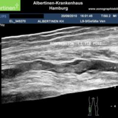 Beinvene - DocCheck Flexikon