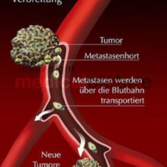 Hämatogen - DocCheck Flexikon
