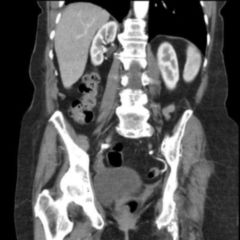 Frontalebene - DocCheck Flexikon