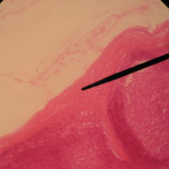 Trabekel - DocCheck Flexikon