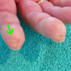 Fingerkuppe - DocCheck Flexikon