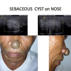 Talg - DocCheck Flexikon