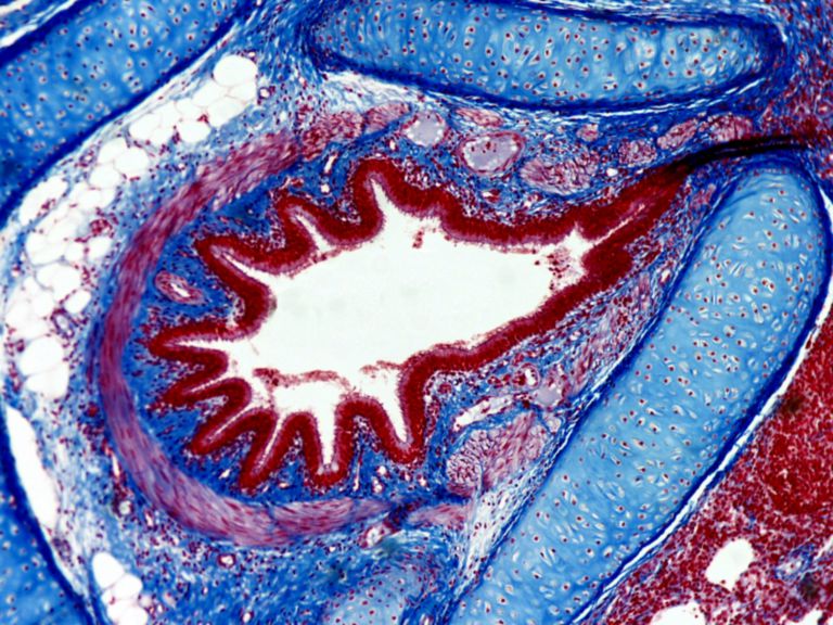 Bronchus segmentalis - DocCheck