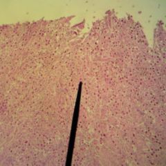 Ganglion geniculatum - DocCheck Flexikon