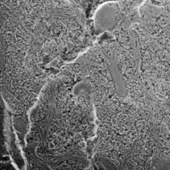 Zellfusion - DocCheck Flexikon