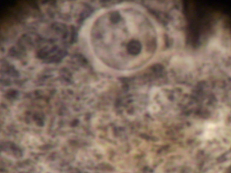 Entamoeba coli - DocCheck