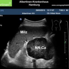 Fachkrankenpflege - DocCheck Flexikon