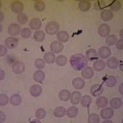 Sporozoit - DocCheck Flexikon