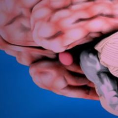 Dysmetrie - DocCheck Flexikon
