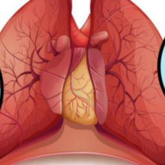Asthma bronchiale - DocCheck Flexikon
