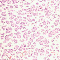 NES - DocCheck Flexikon