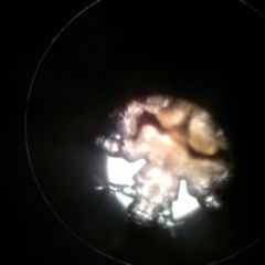 Filzlaus - DocCheck Flexikon