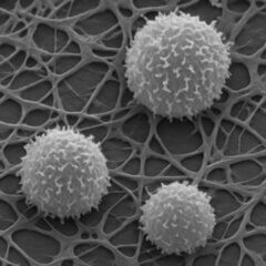 Rasterelektronenmikroskop - DocCheck Flexikon