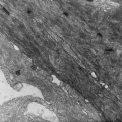 Caveola - DocCheck Flexikon