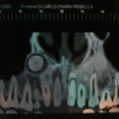 Eckzahn - DocCheck Flexikon