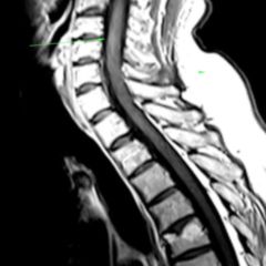 Halswirbelsäule - DocCheck Flexikon
