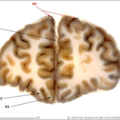 Stria longitudinalis - DocCheck Flexikon